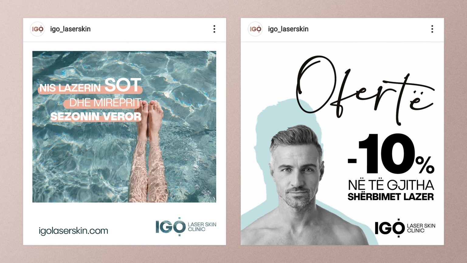 IGO Laser Skin - Instant marketing for people who love themselves